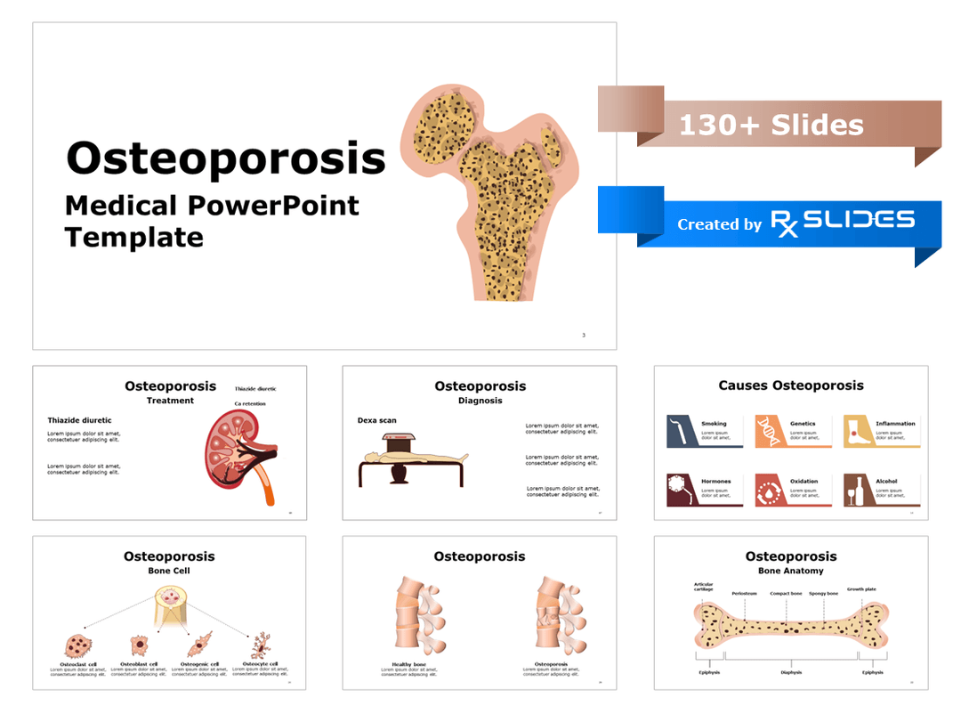 Download Rheumatoid Arthritis PowerPoint Template|RxSlides